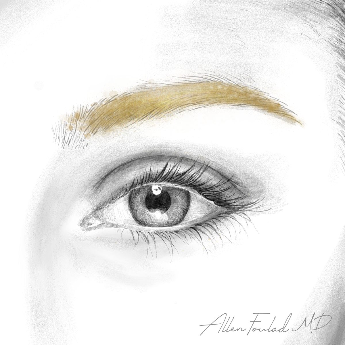 Lateral Brow Lift in Beverly Hills | Allen Foulad MD