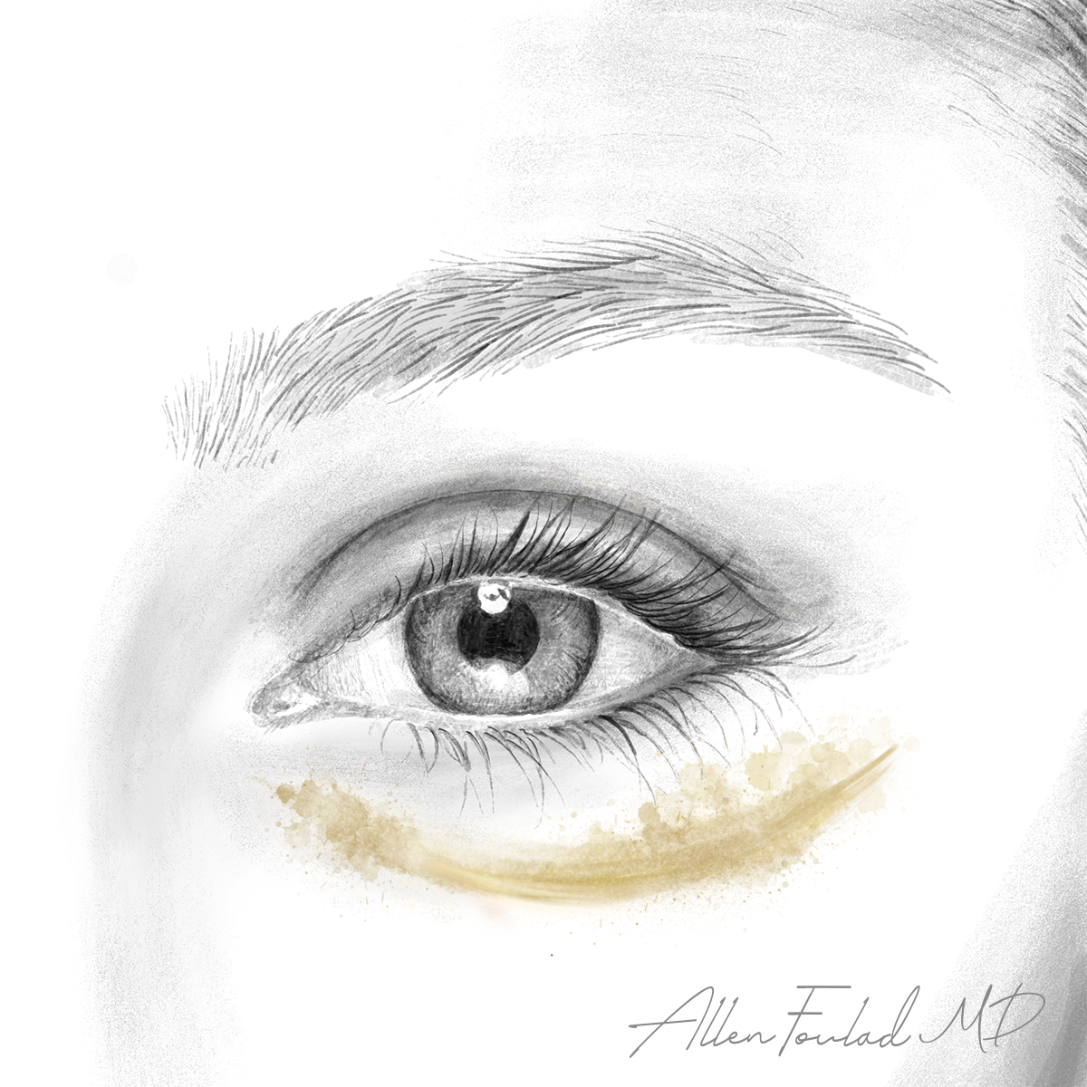 Eyelid Surgery in Beverly Hills | Allen Foulad MD